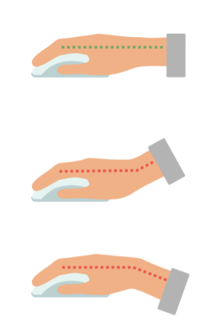Module 5: All Mice Are Not Created Equal – Cascade Ergonomics